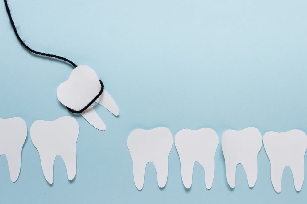 Get Comfortable With Tooth Extractions - Mission Hill Dental